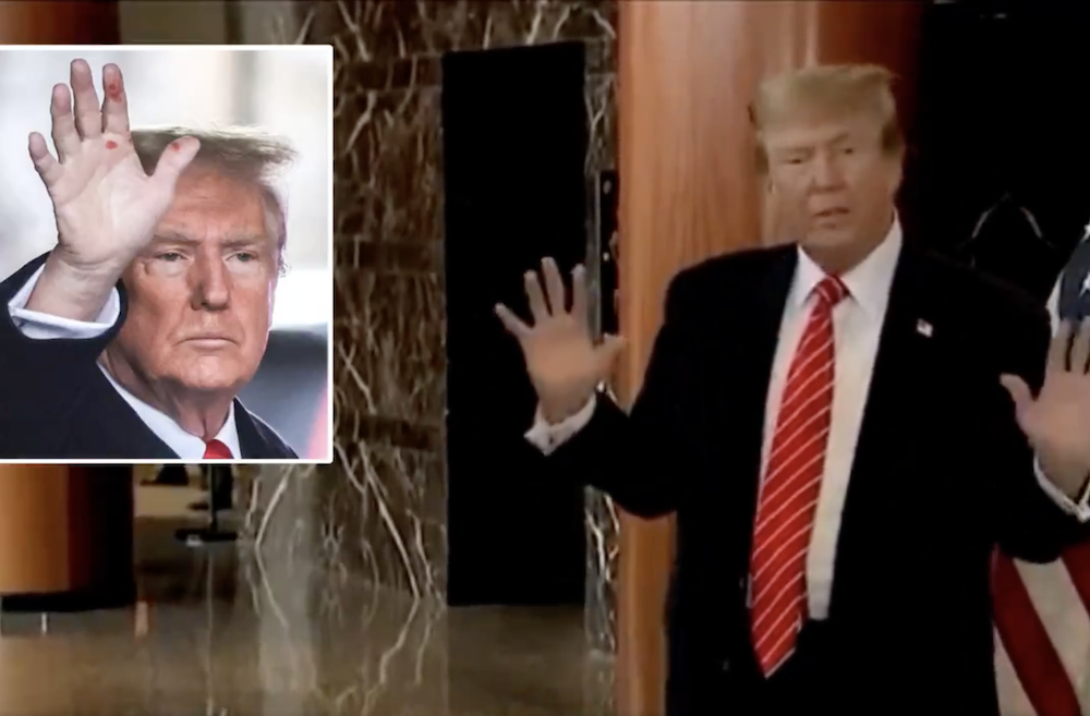 WATCH: Trump Makes Reporters Erupt In Laughter With Joke About His Hand